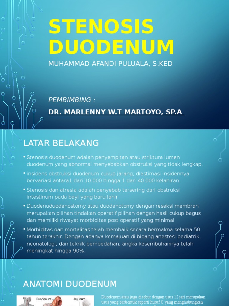 Stenosis Duodenum | PDF