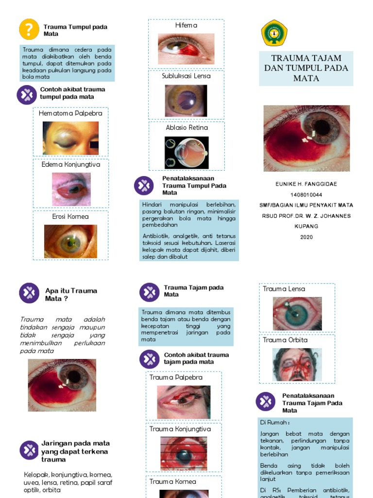 Leaflet Trauma Tajam Tumpul Pada Mata | PDF