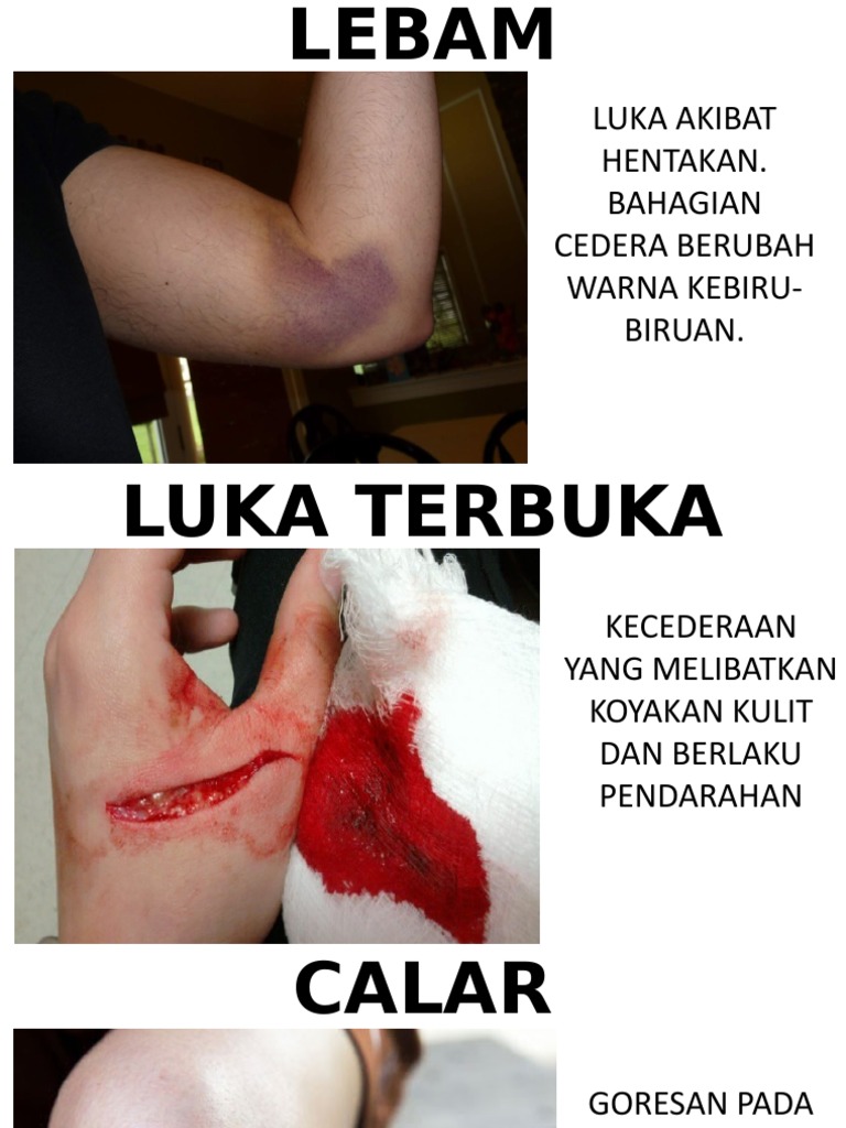 Cedera Sehari-hari dan Penanganannya | PDF | Seni