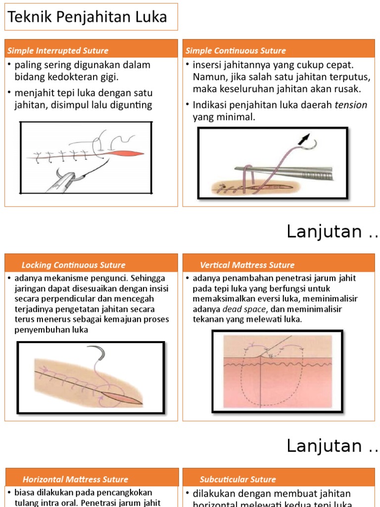 Teknik Penjahitan Luka di Bidang Kedokteran Gigi | PDF