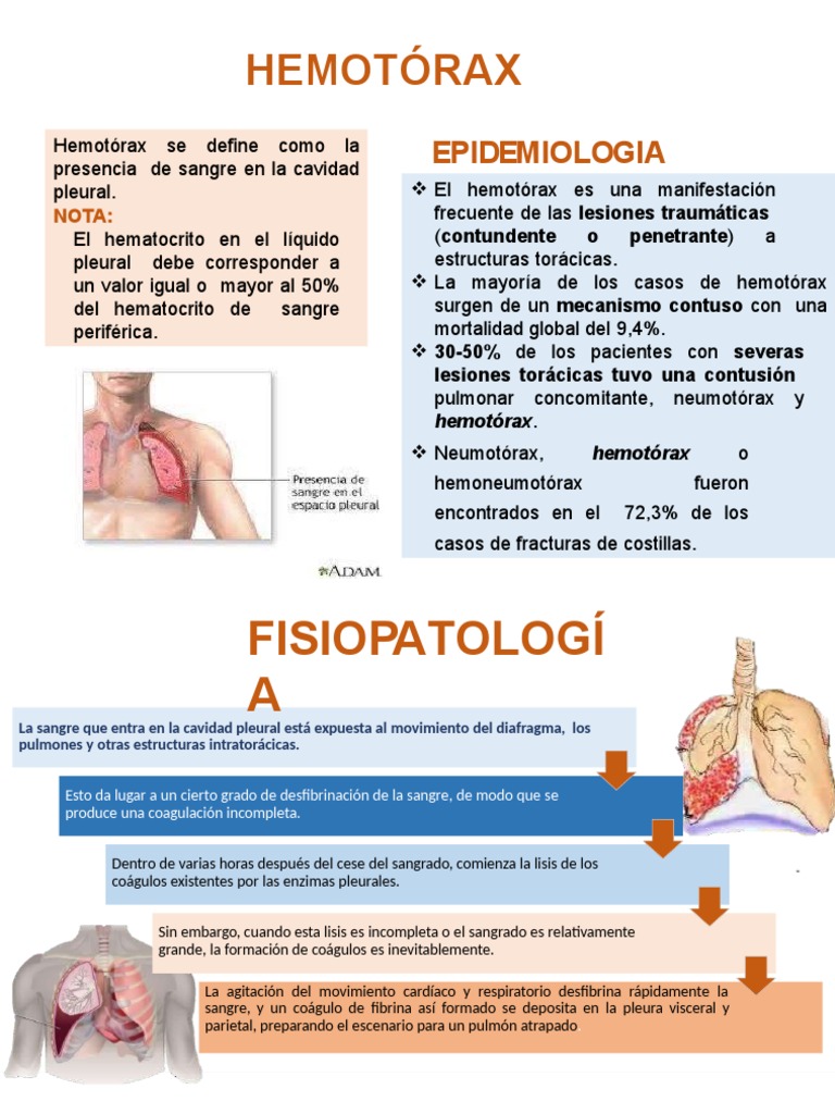 Fisiopatología y manejo del hemotórax | PDF | Pulmón | Emergencias Médicas