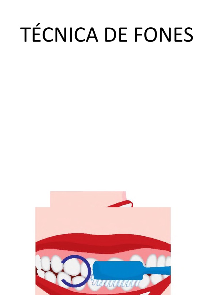 Técnica de Fones | PDF
