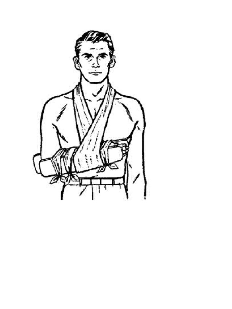 Bidai Pada Fraktur Antebrachii | PDF