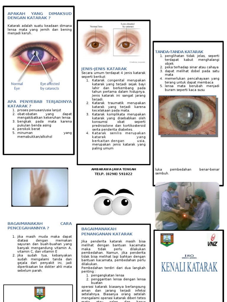 Leaflet Katarak | PDF