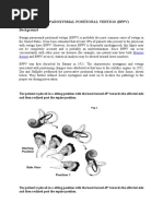 Supine Roll Test for HC-BPPV Diagnosis | PDF | Vertigo | Diseases And ...
