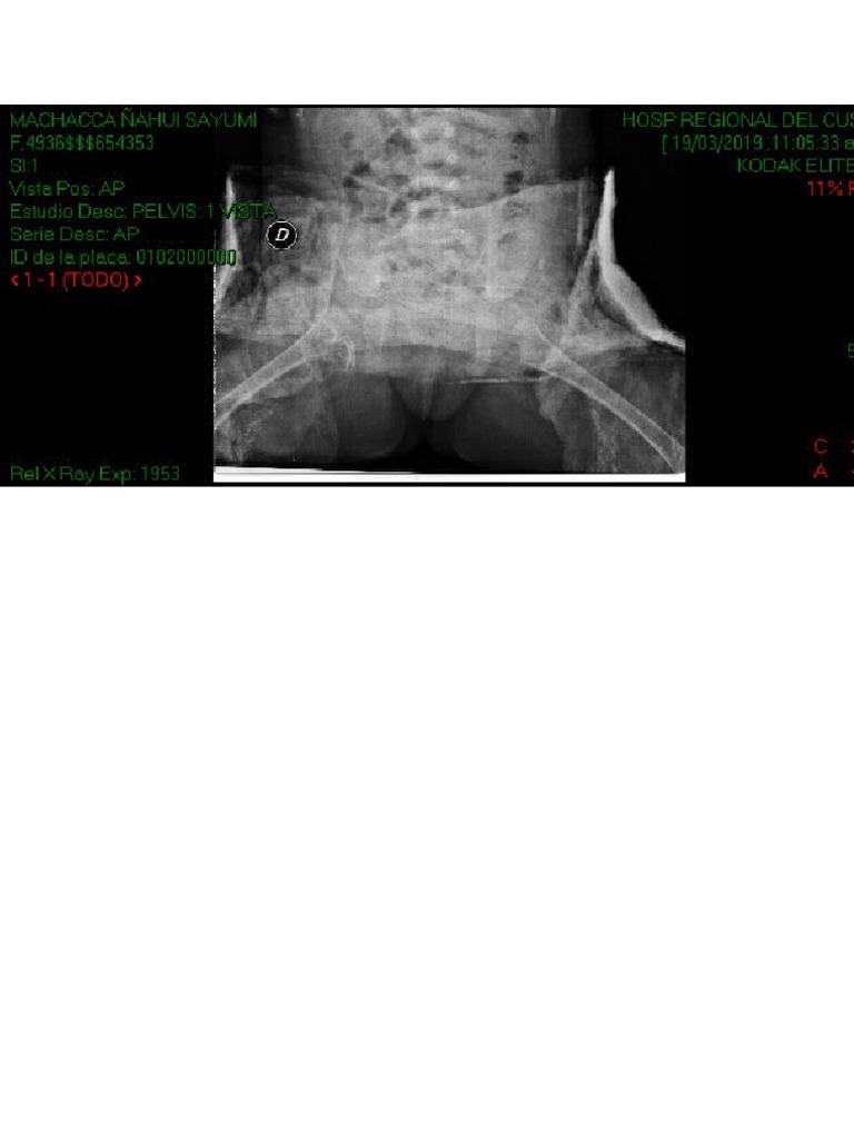 Presentación PPPPPPPP | PDF