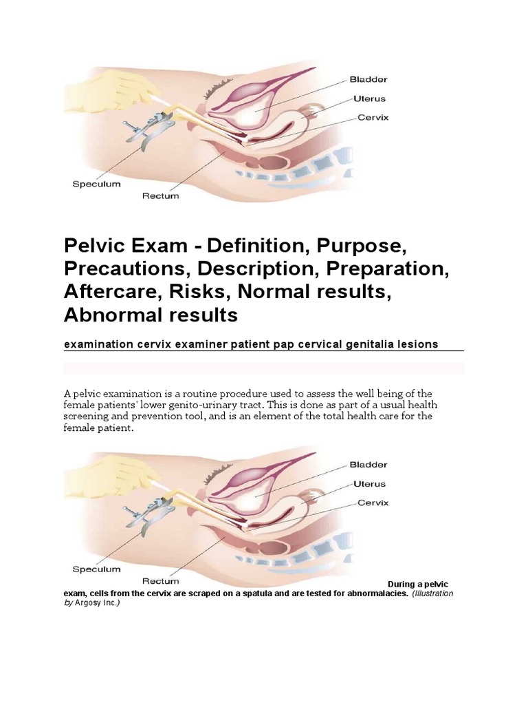 Pelvic Exam Definition Purpose Precautions Description