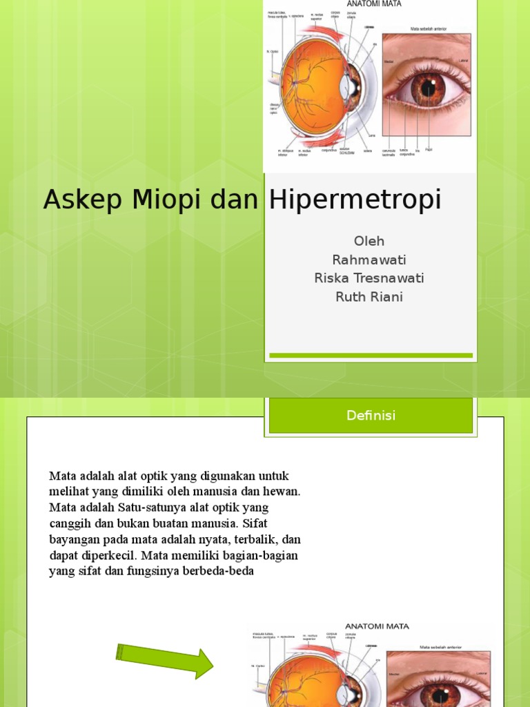 Miopia Hipermetro | PDF