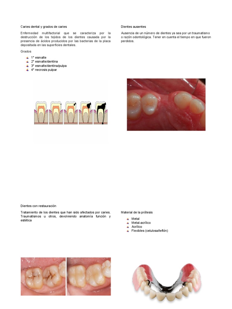 Caries Dental y Grados de Caries | PDF | Anatomia dental | Anatomia animal