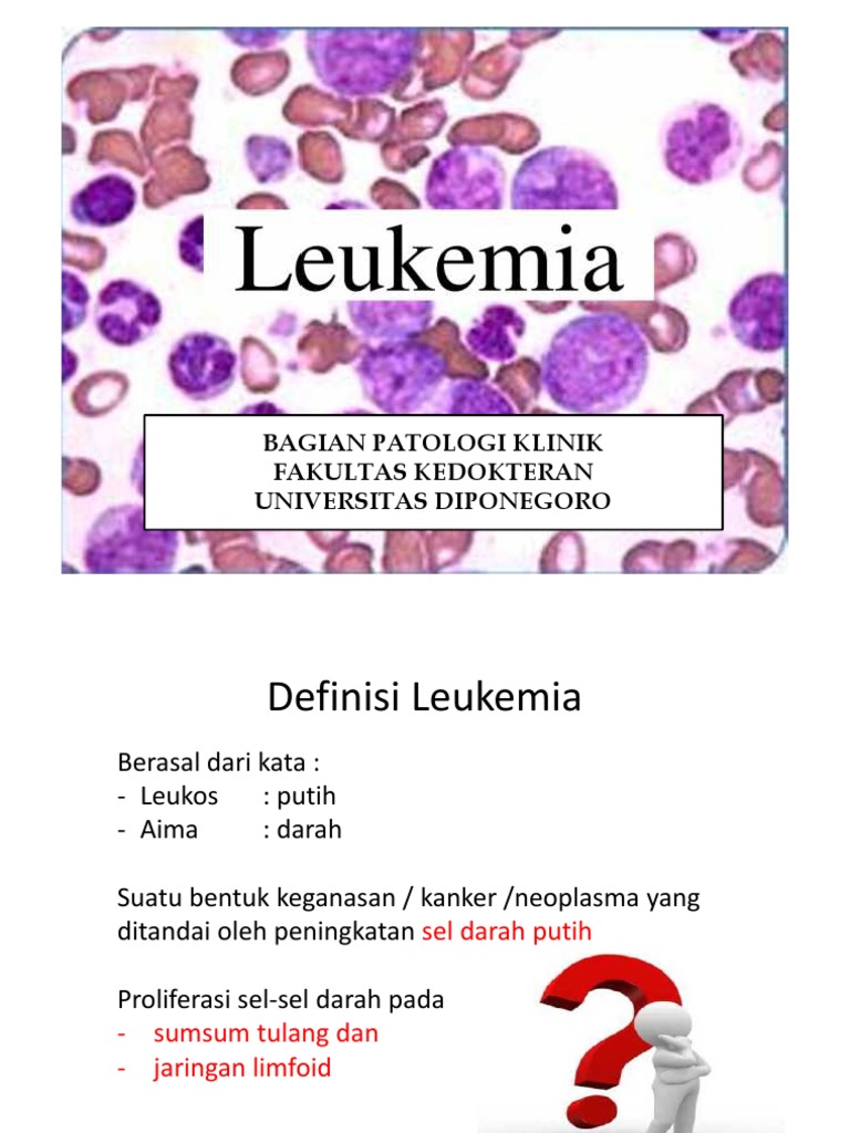 5 Leukemia | PDF
