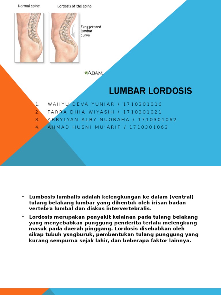 Lumbar Lordosis | PDF