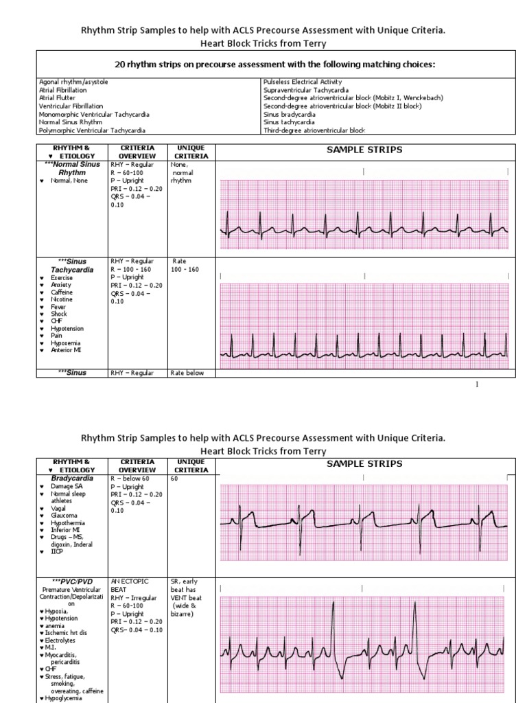 ECG Tips | PDF | Cardiovascular Diseases | Electrophysiology