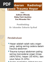 Contusio Musculorum | PDF