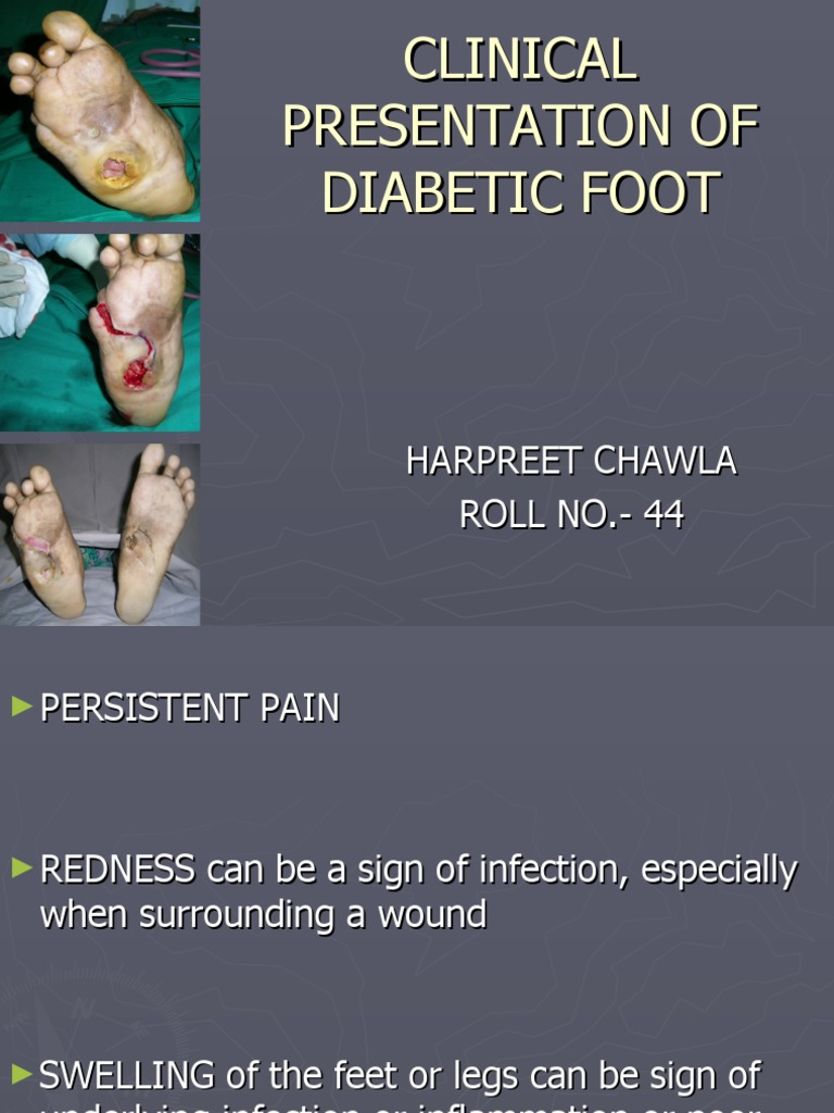 Clinical Presentation of Diabetic Foot | PDF | Foot | Toe