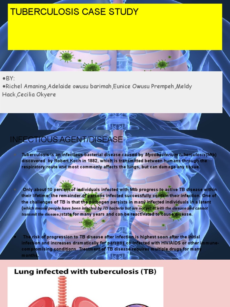 Group 4 Tuberculosis Case Study 2 | Download Free PDF | Tuberculosis ...