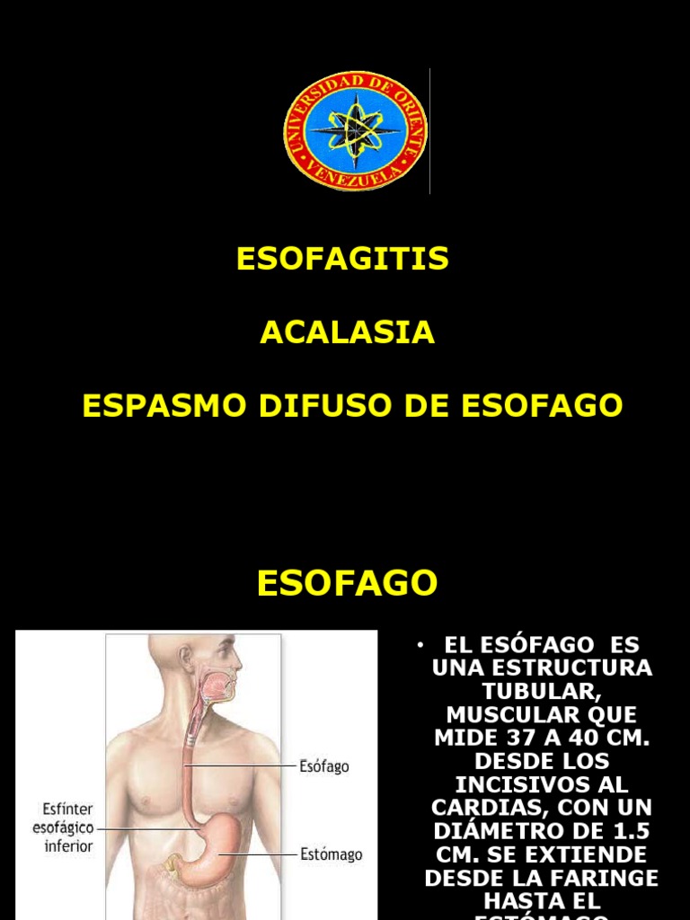 Clasificación y Tratamiento de Esofagitis | PDF | La enfermedad por ...