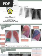 PDF Anatomi Thorax Normal Gambaran Radiologi Compress | PDF