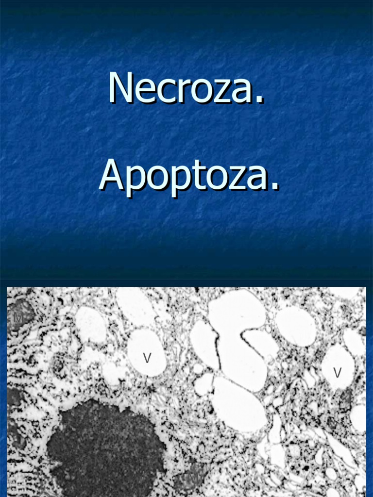 NECROZA | PDF