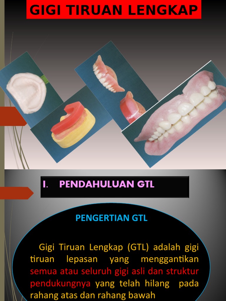 Panduan Gigi Tiruan Lengkap (GTL) | PDF