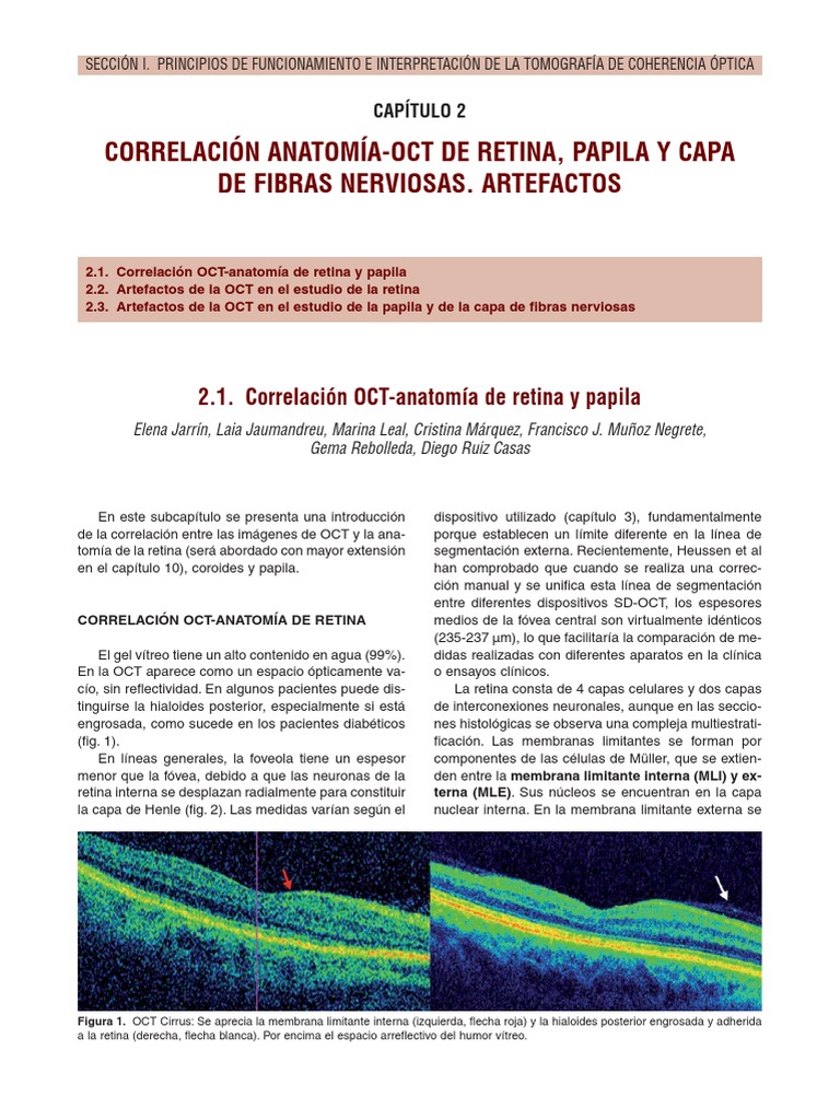 CORRELACIÓN ANATOMÍA-OCT DE RETINA, PAPILA Y CAPA DE FIBRAS NERVIOSAS ...