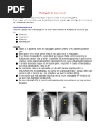 Proyecciones Rx de Tórax: PA y AP | PDF | Tórax (anatomía humana ...