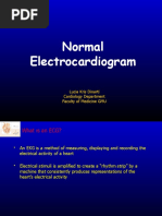 Basic ECG Workshop For Paramedics | PDF | Electrocardiography ...