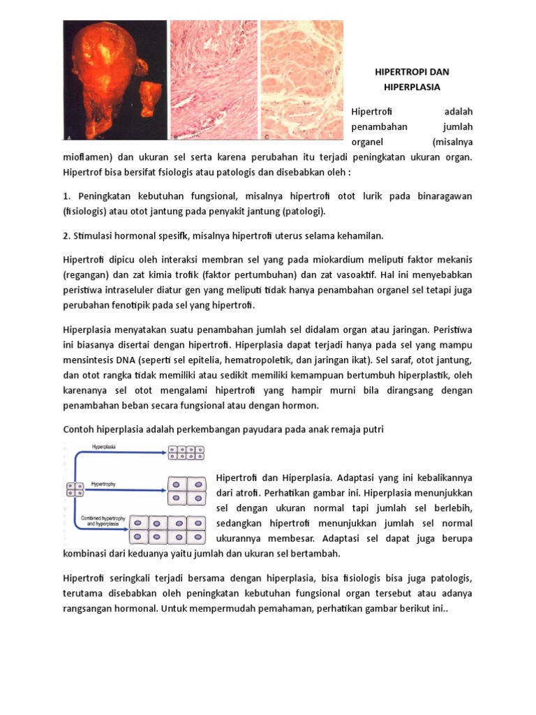 Perbedaan Hipertrofi dan Hiperplasia | PDF | Kesehatan Holistik