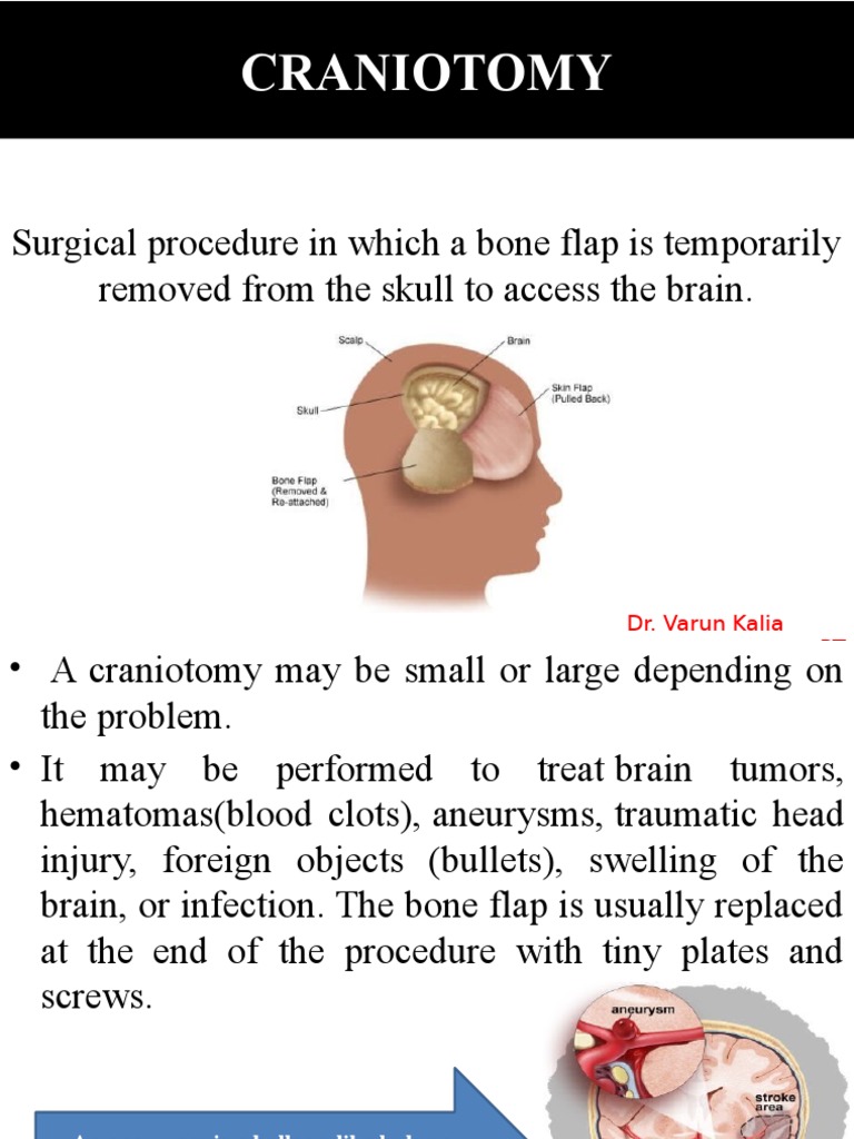 CRANIOTOMY | PDF | Surgery | Neurosurgery