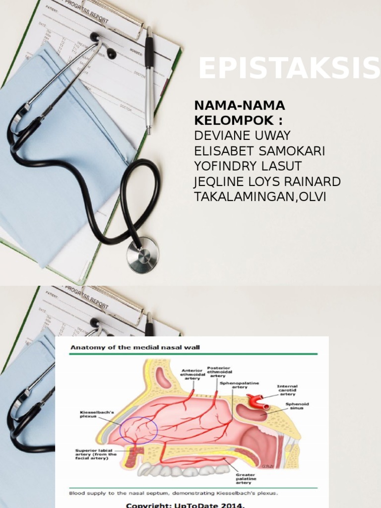 Epistaksis 1 | PDF