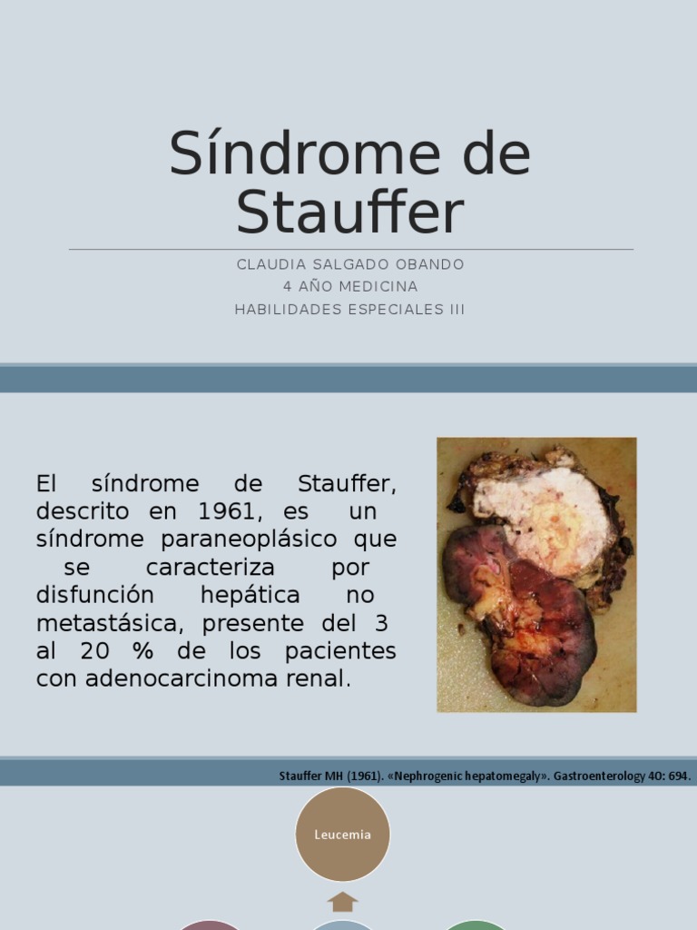 Síndrome de Stauffer | PDF
