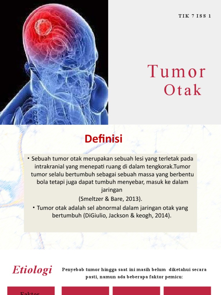 Tumor Otak | PDF