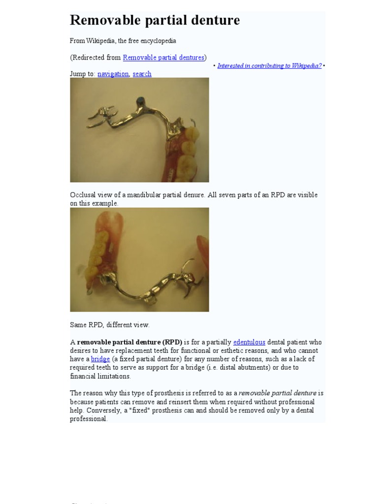 Removable Partial Denture | PDF | Dentistry | Dentistry Branches