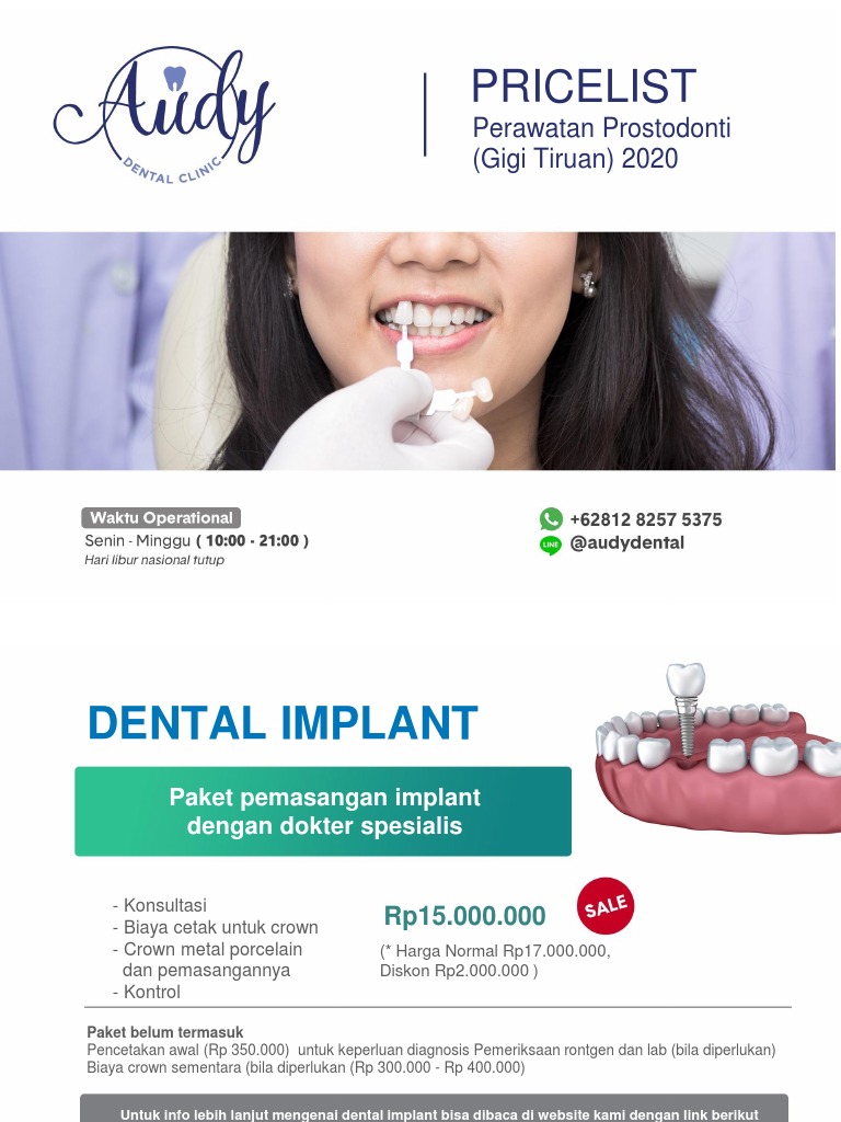 Pricelist Audy Dental Gigitiruan 2020 | PDF