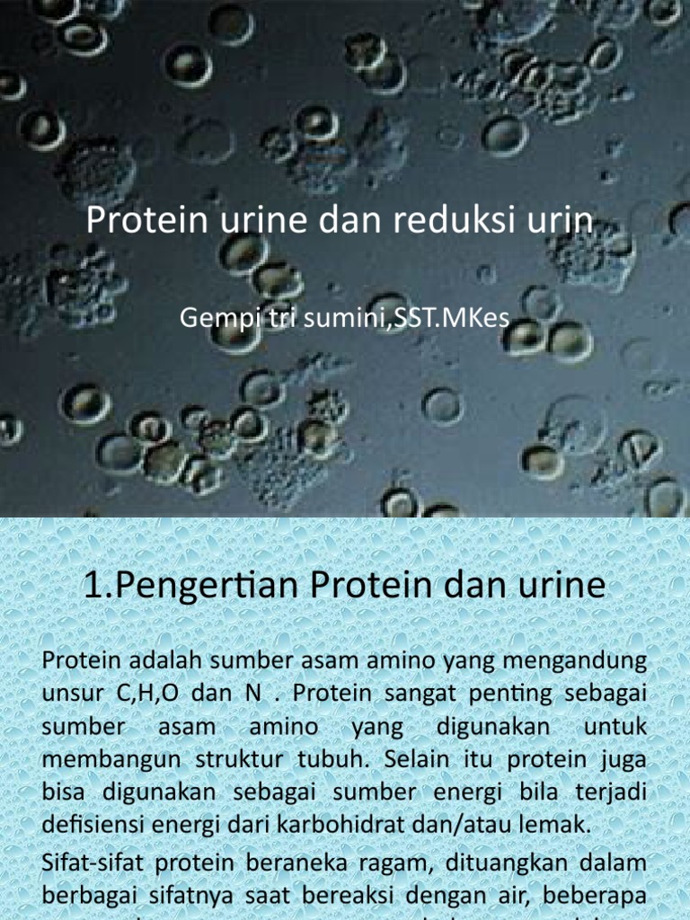 Protein Urine Dan Reduksi Urin | PDF