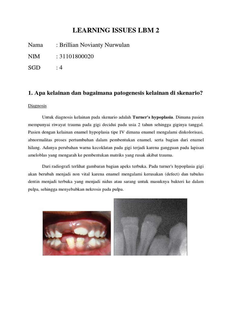 Learning Issue LBM 2 Brillian Novianty N PDF | PDF