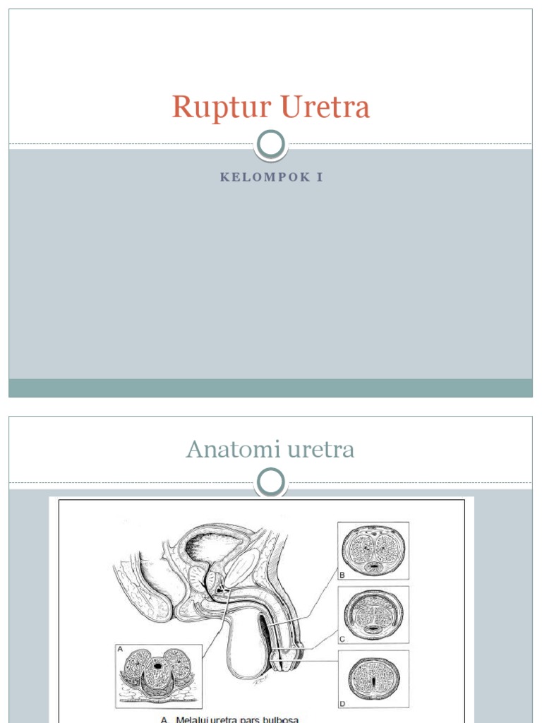 Ruptur Uretra | PDF