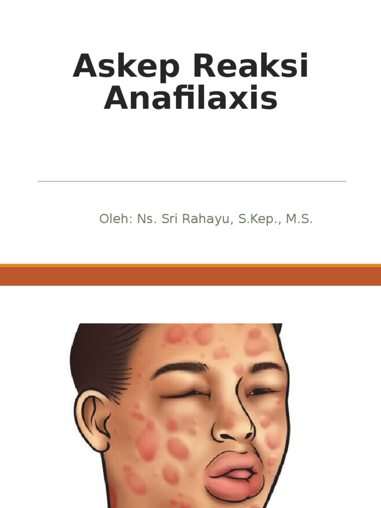 Askep Reaksi Anafilaksis | PDF