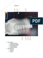 Potongan CT Scan: Axial, Sagital, Coronal | PDF | Griya & Taman | Sains ...