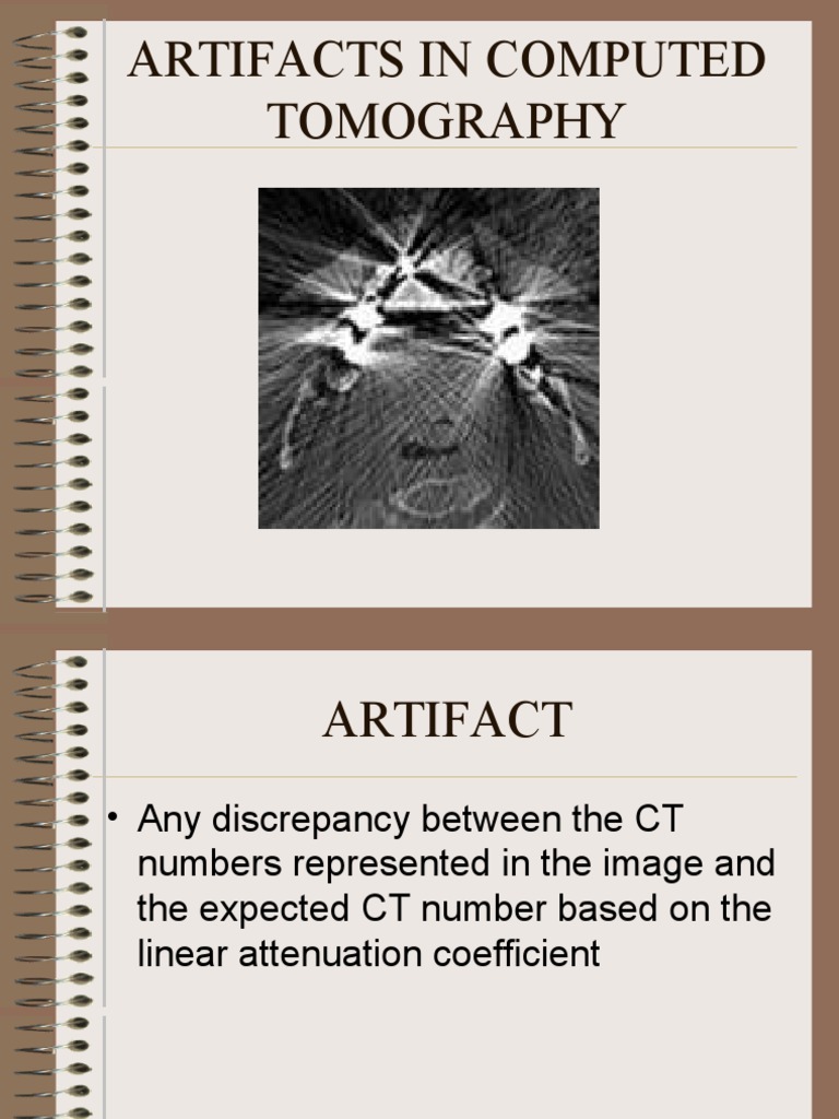 Artifacts in Computed Tomography | PDF | Ct Scan | Medical Physics