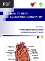16-Handout - ECG Interpretation (Study This) | PDF ...