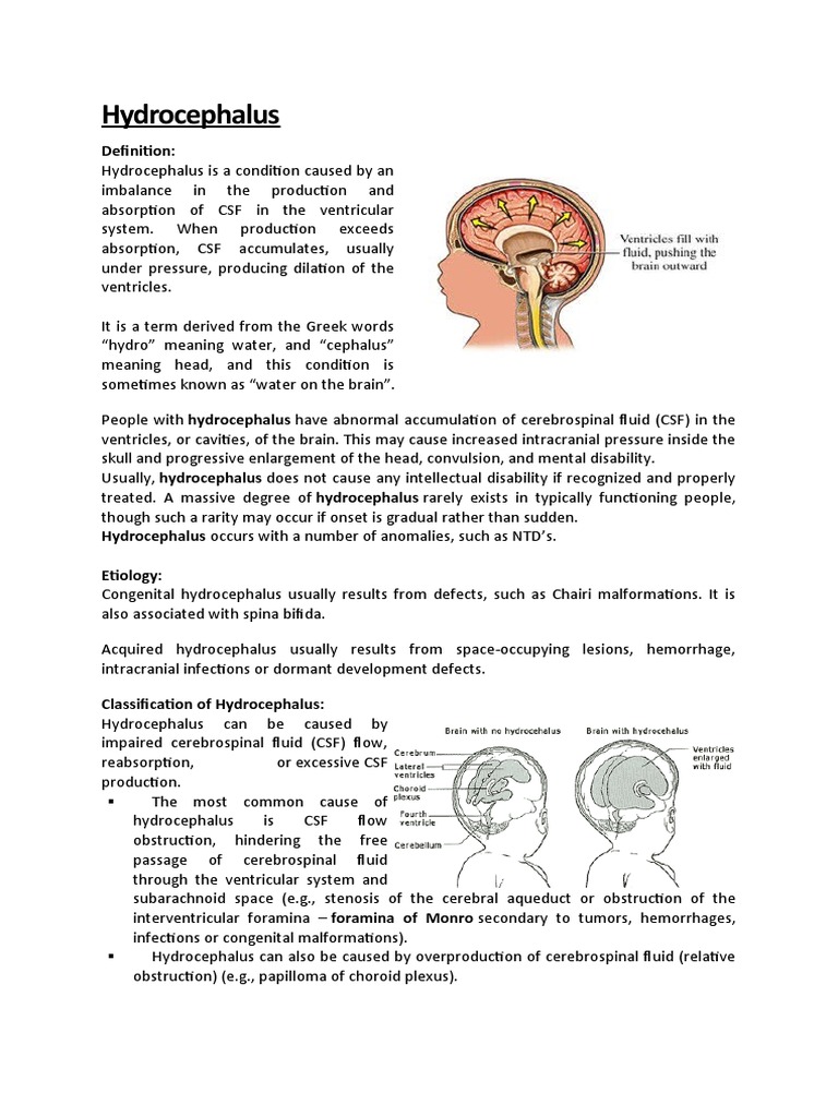 Hydrocephalus AND Neural Tube Defect | PDF | Cerebrospinal Fluid ...
