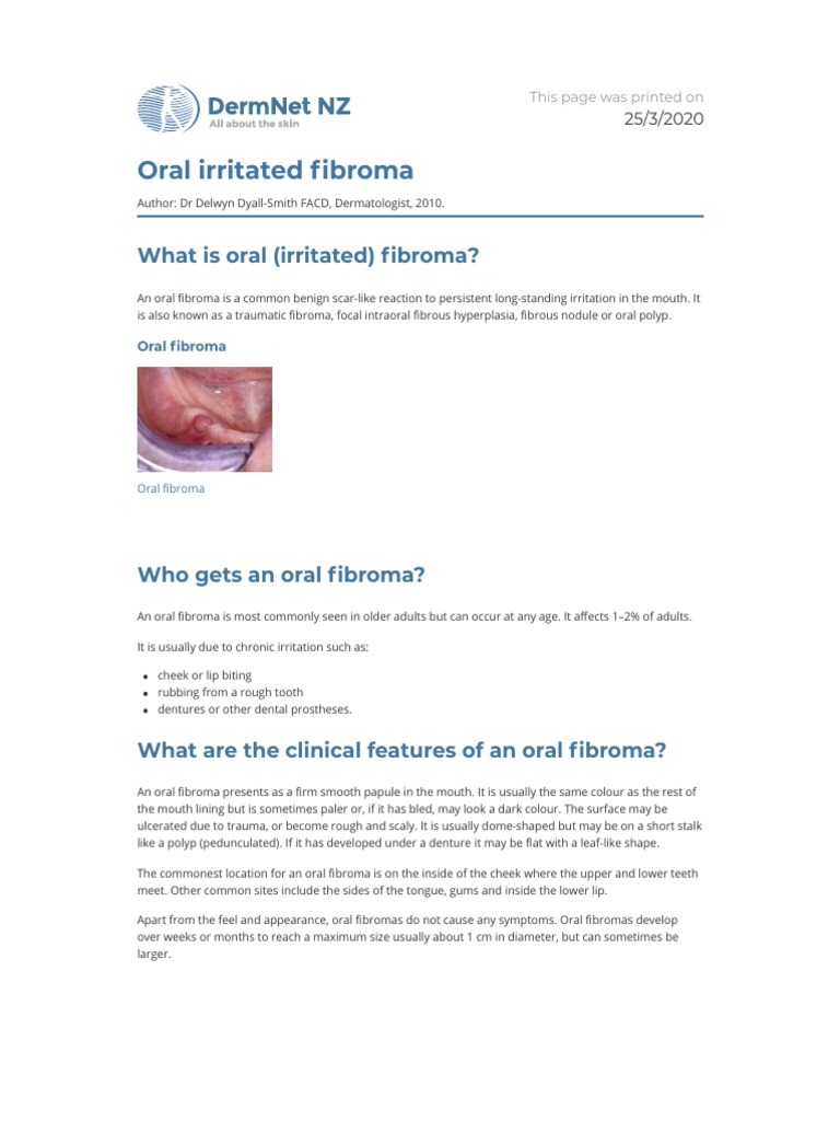 Oral Fibromas: Diagnosis and Treatment | PDF | Mouth | Medicine