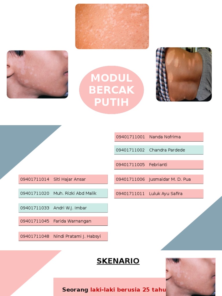 Modul Bercak Putih | PDF