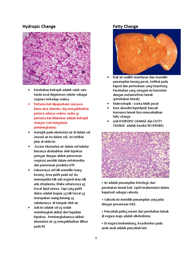 Ringkesan Cedera Sel | PDF