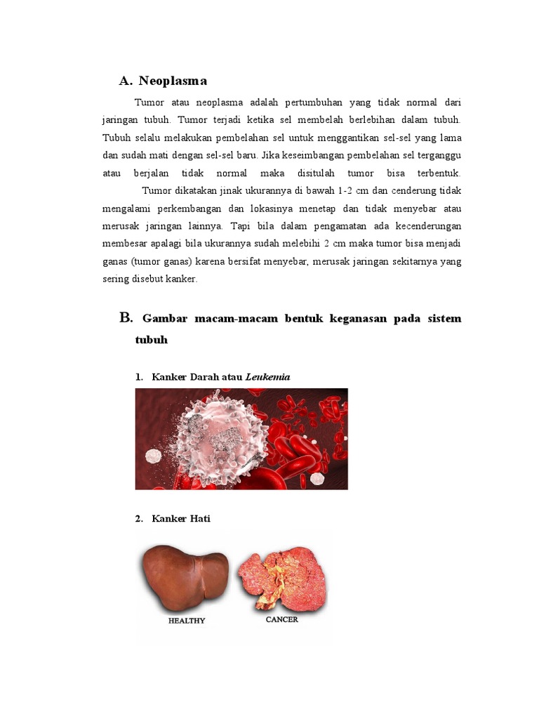 Patofisiologi Neoplasma | PDF