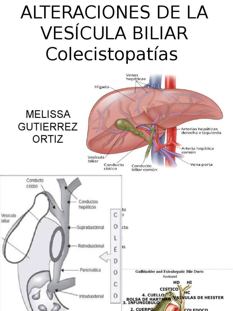Anatomiadavesiculabiliarbolsahartmann