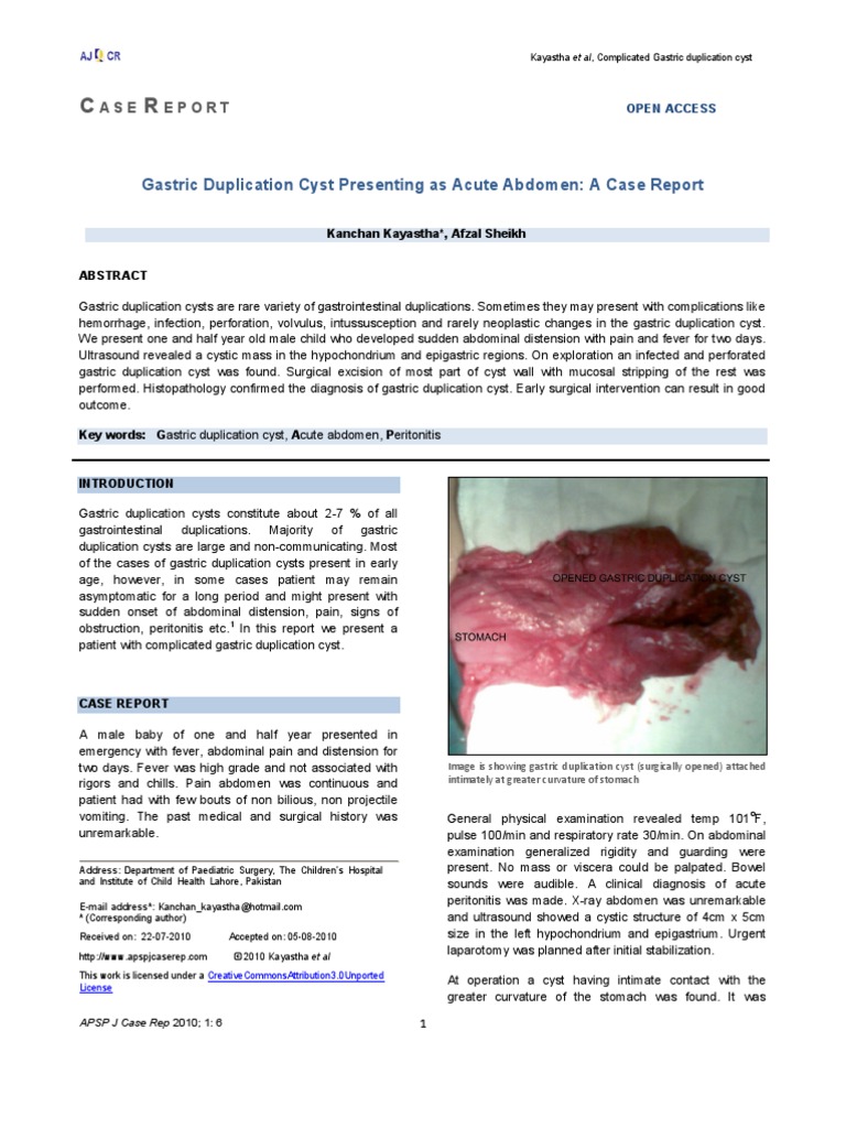 Gastric Duplication Cyst Presenting As Acute Abdomen A Case Report Stomach Surgery