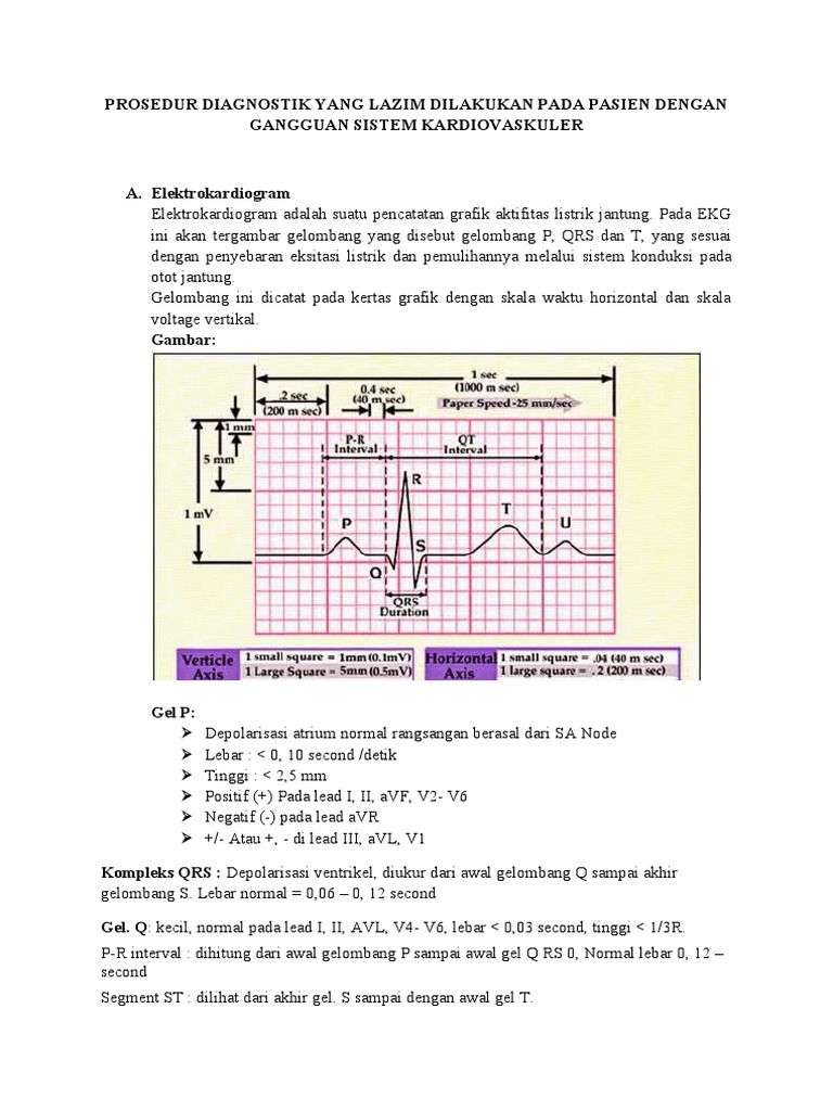 SOP EKG - Dox | PDF
