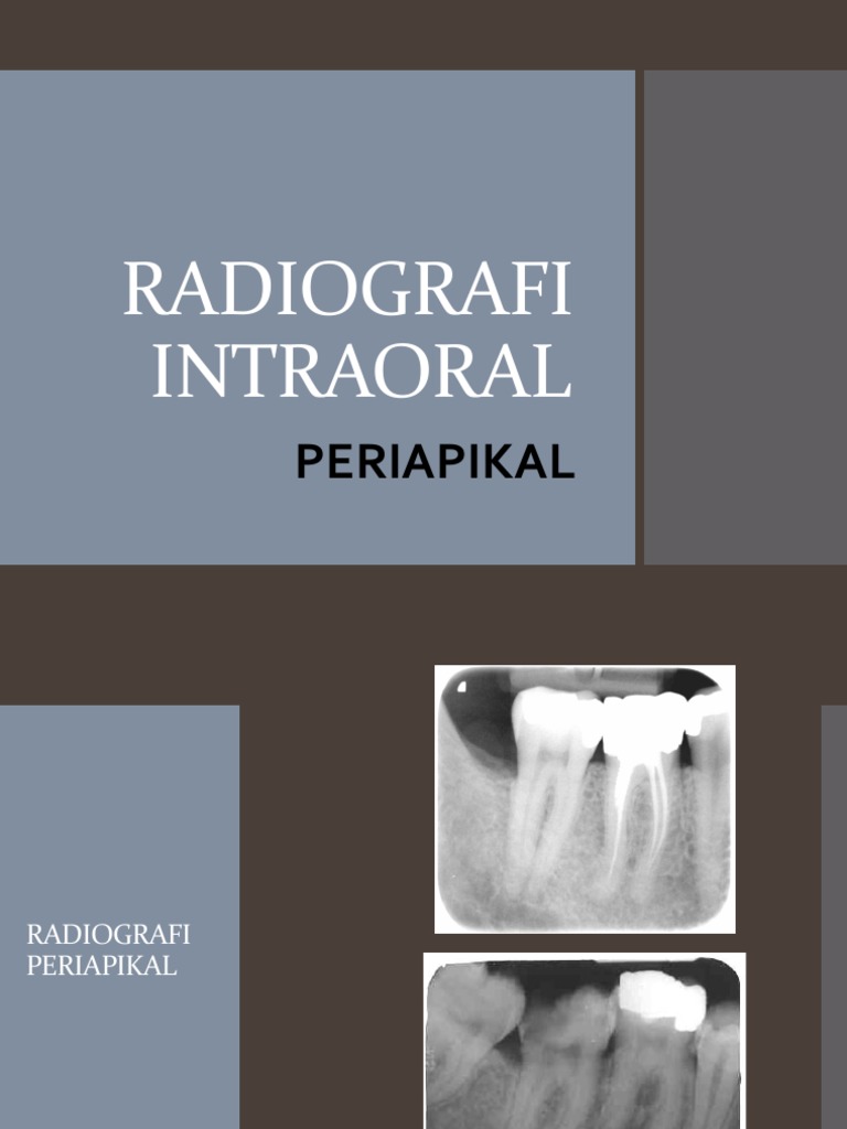 RADIOGRAFI Periapikal | PDF