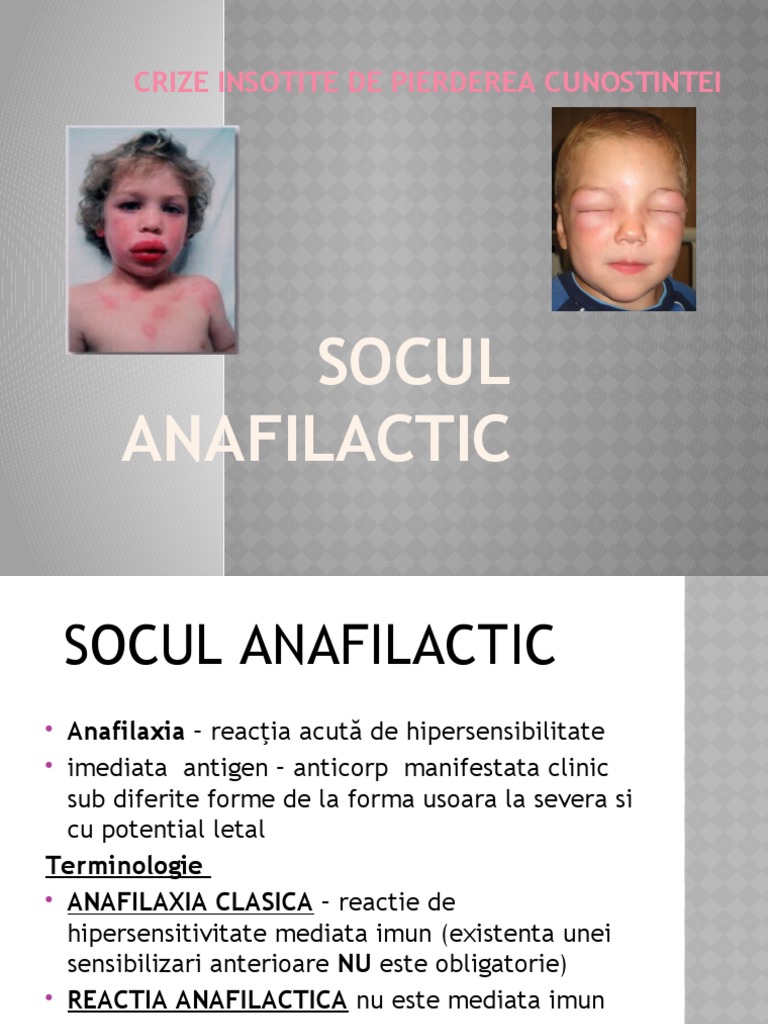 Socul Anafilactic | PDF